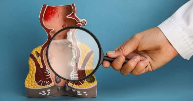 Sipoly kezelése házilag? 5 eset, amikor rögtön fordulj orvoshoz - Hóvége